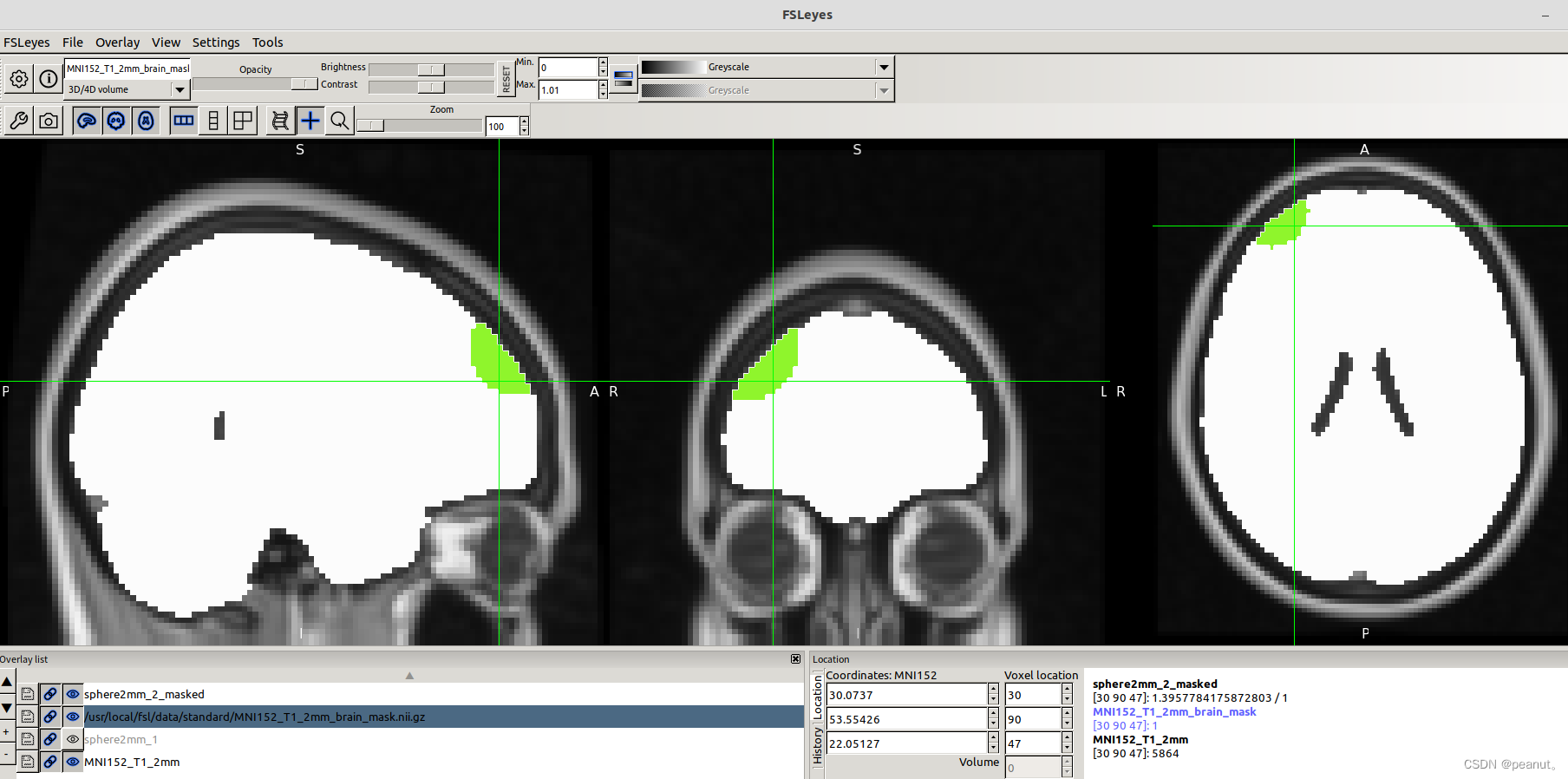 【Medical Image】MRI结构像自定义脑部ROI-基于FSL_mrview mrtrix 绘制roi-CSDN博客