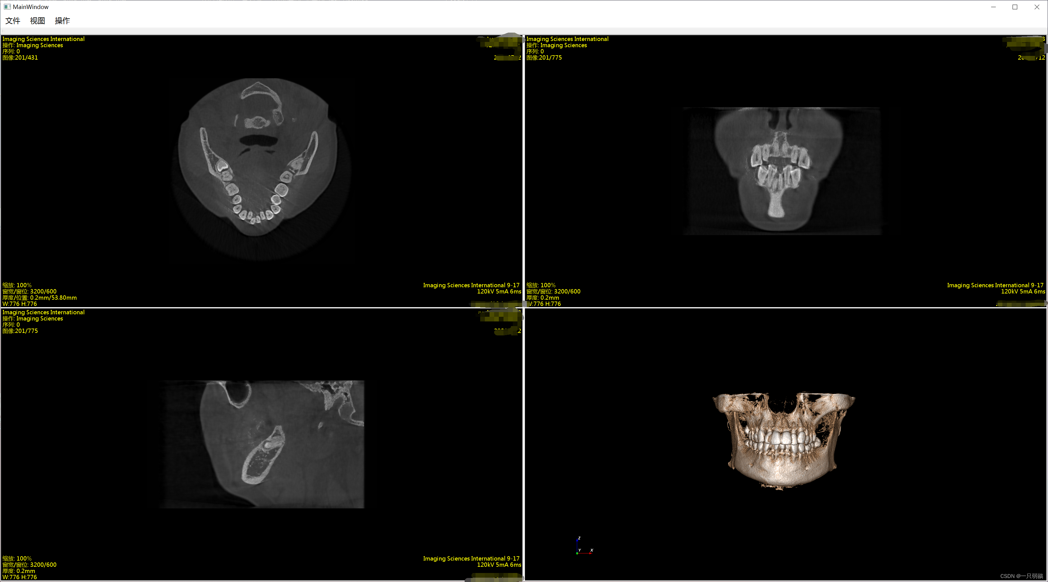 使用GDCM读取DICOM Series-CSDN博客