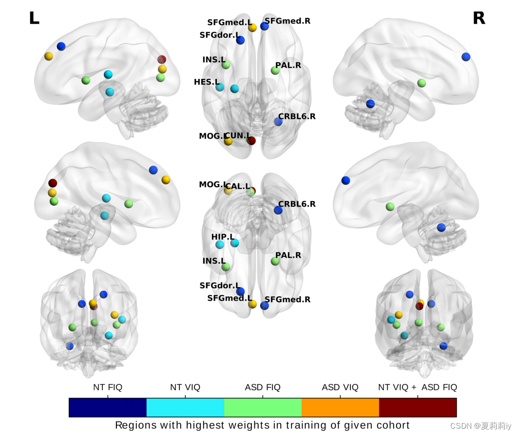 [论文精读]Predicting cognitive scores with graph neural networks throughsample selection learning ...