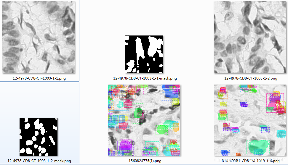 mask-r-cnn，unet，unet++三种算法实现细胞分割的对比心得_unet和mask r-cnn效果对比-CSDN博客