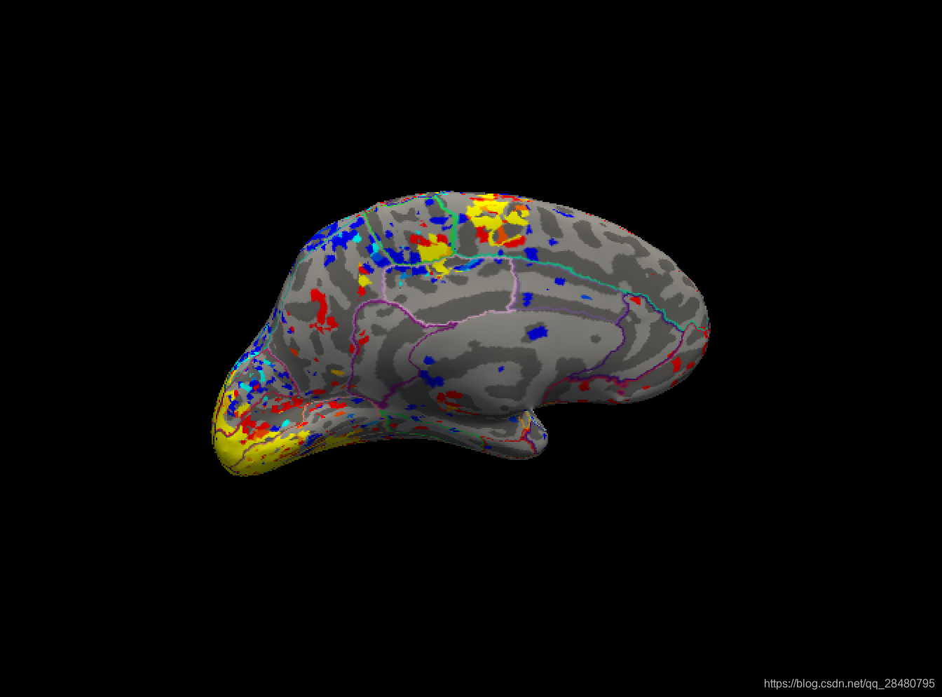 Freesurfer学习笔记——Multimodal Integration(2.1 Individual fMRI Integration ...