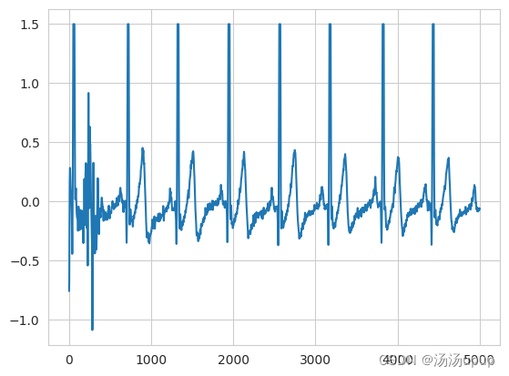 ECG-Emotion Recognition（情绪识别）-- 数据集介绍WESAD&DREAMER_wesad数据集-CSDN博客