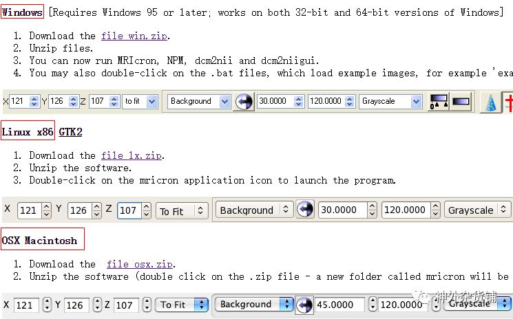 dicom影像资料_将Dicom格式转换为Nifti文件方法1-CSDN博客