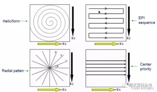 MRI的原始空间——K-Space_磁共振k空间-CSDN博客