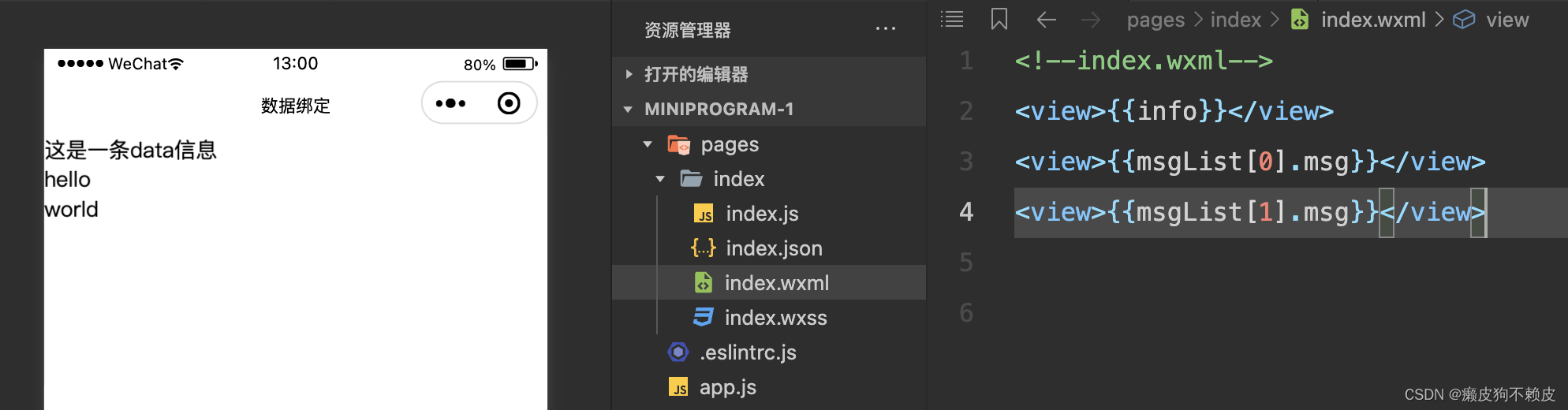WXML模板语法-数据绑定_小程序wxml模板-CSDN博客