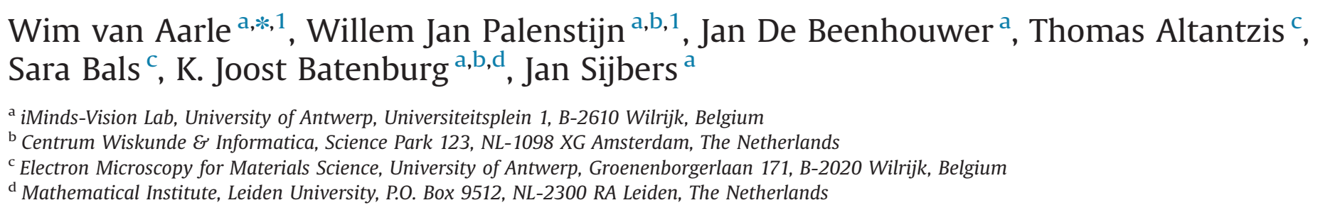 The ASTRA Toolbox: A platform for advanced algorithm development in electron tomography-CSDN博客