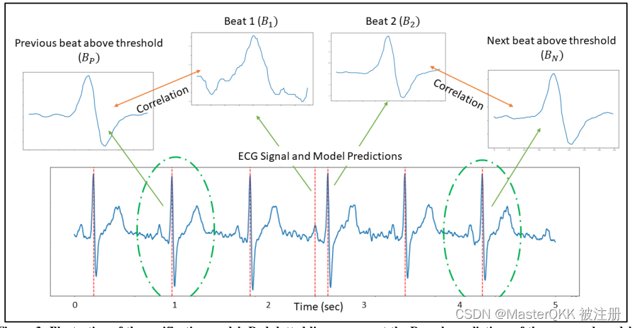 [论文评析]Robust R-Peak Detection in Low-Quality Holter ECGs using 1D Convolutional Neural Network ...