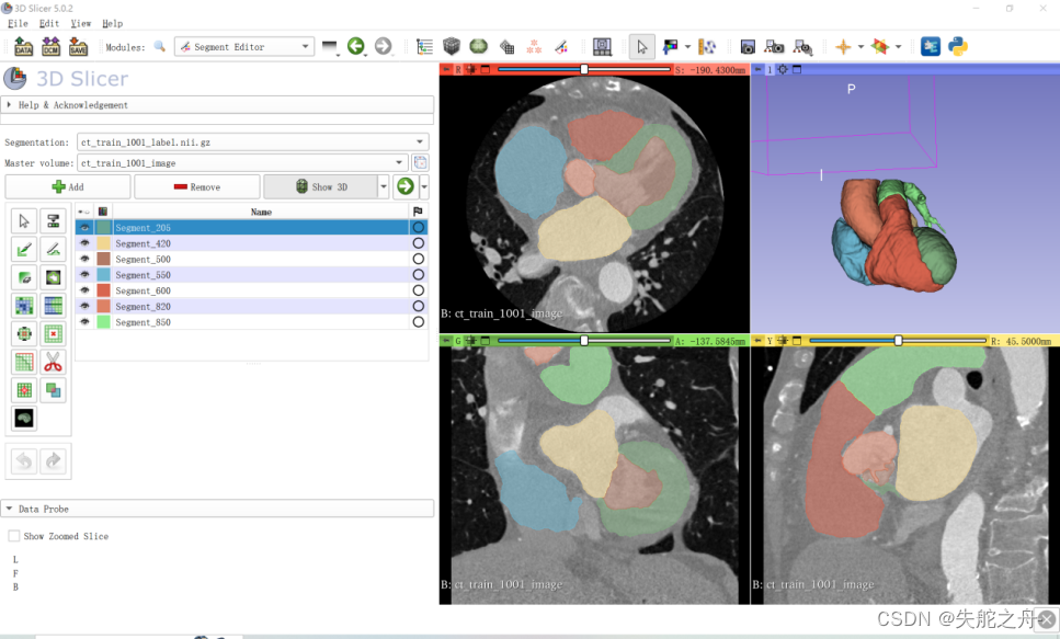 【3D Slicer】心脏CT图像分割操作保姆级教程 Cardiac CT image segmentation-CSDN博客