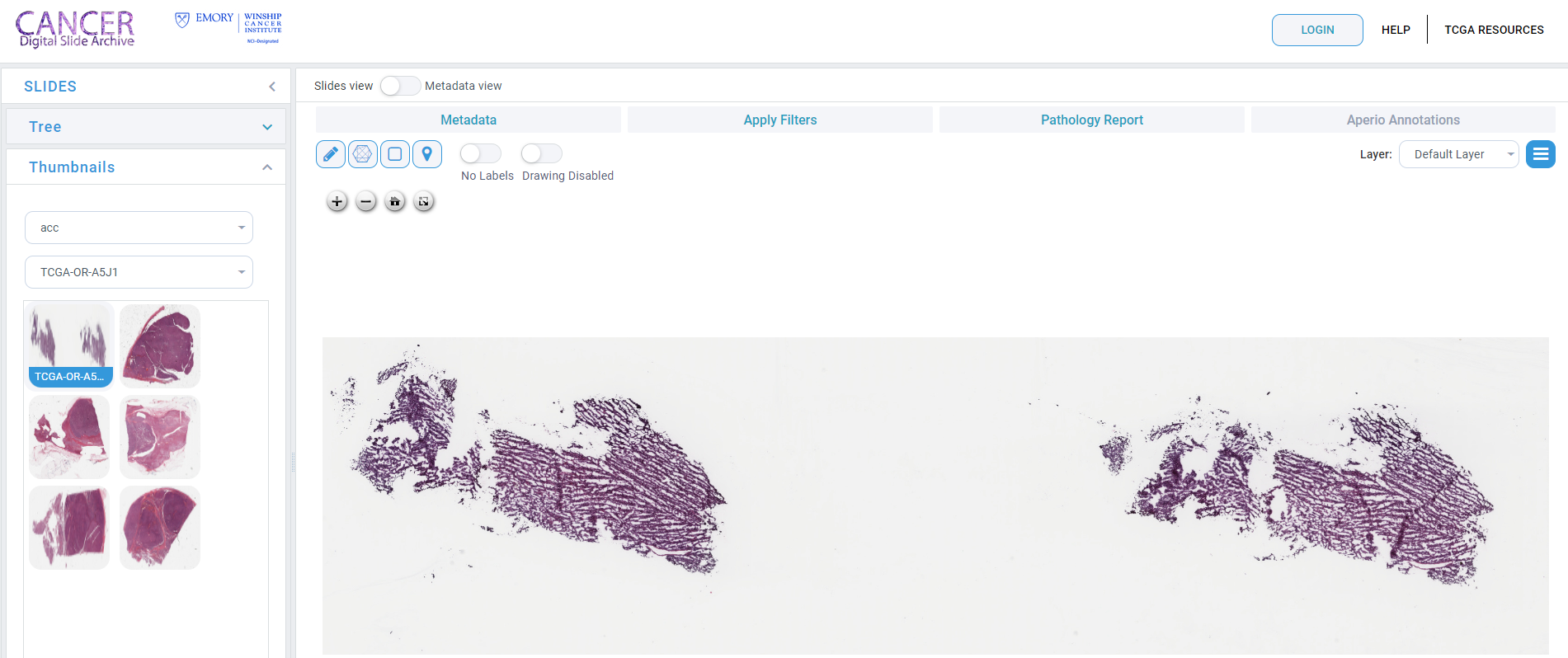 医学图像 开源数据整理合集1_qidw公共ct数据集-CSDN博客