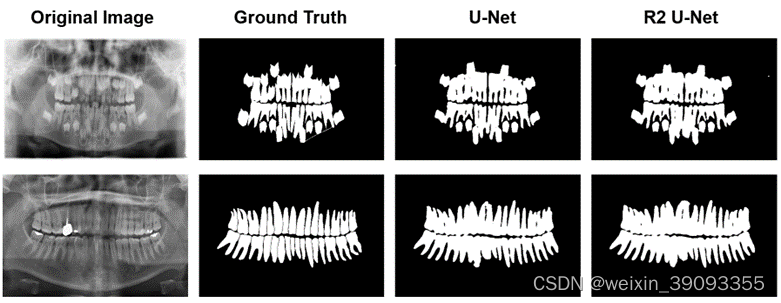 使用UNet+mmsegmentation完成全景X射线图像牙齿分割任务(阿里天池题目)_mmsegmentation unet-CSDN博客