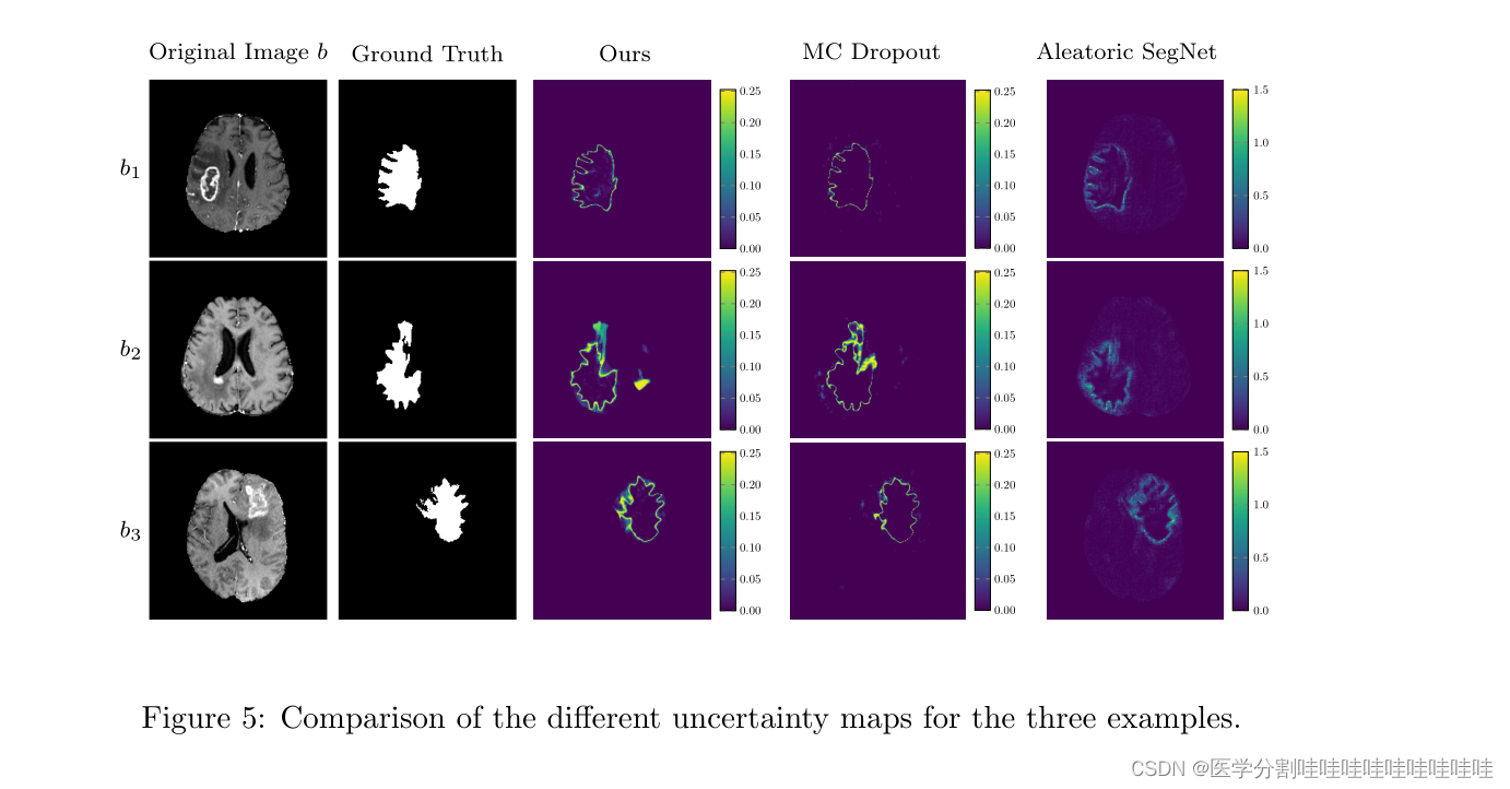 Diffusion Models for Implicit Image Segmentation Ensembles-CSDN博客