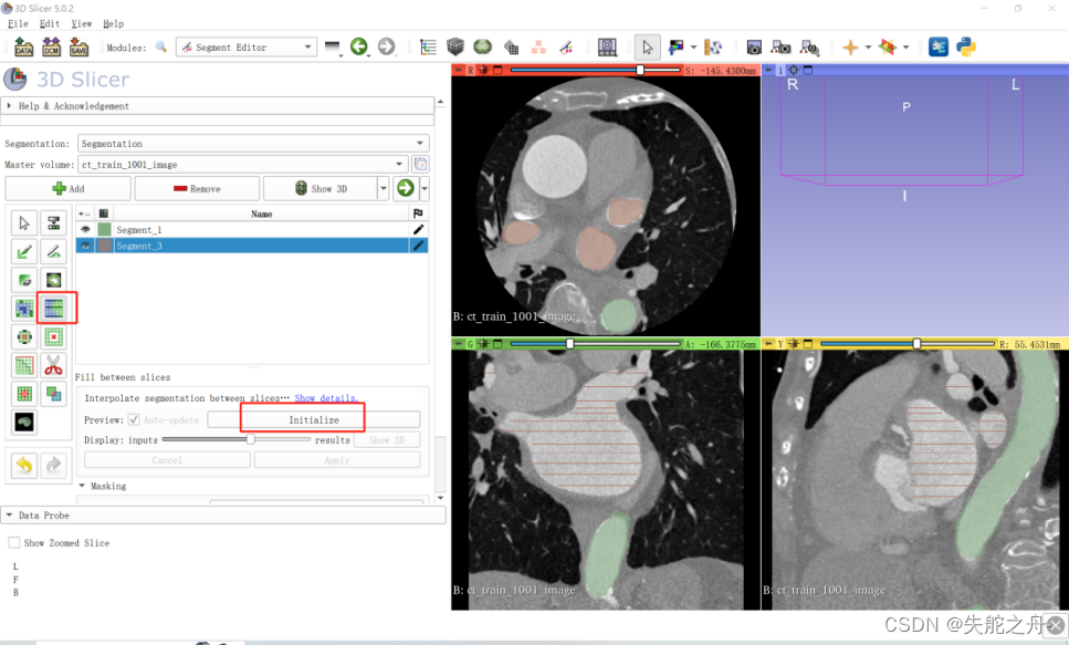 【3D Slicer】心脏CT图像分割操作保姆级教程 Cardiac CT image segmentation-CSDN博客