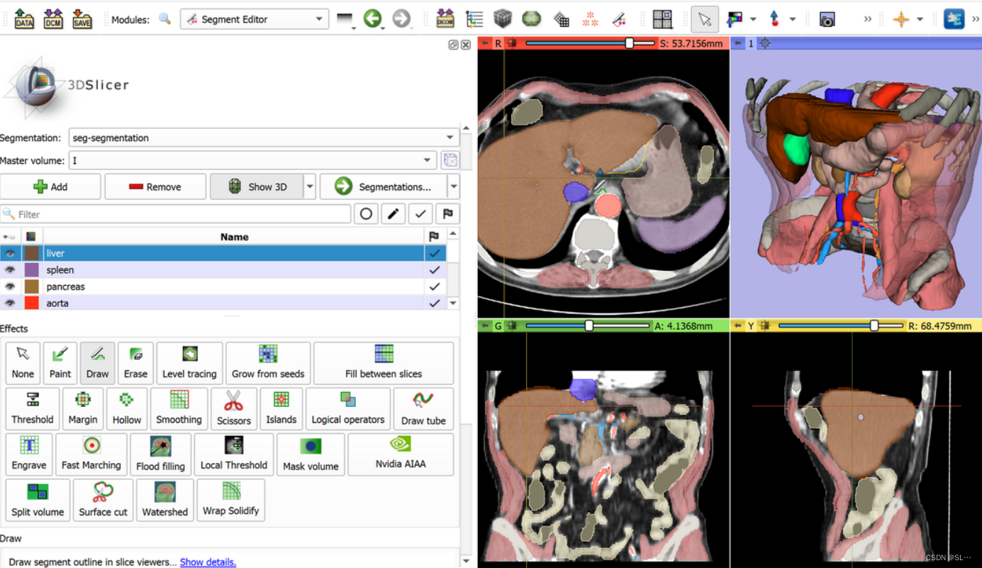 ubuntu编译3D Slicer5.0_ubuntu下编译3d slicer-CSDN博客