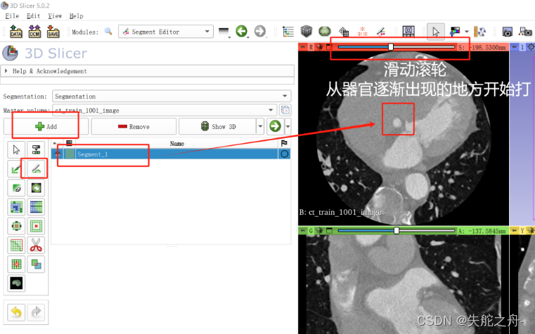 【3D Slicer】心脏CT图像分割操作保姆级教程 Cardiac CT image segmentation-CSDN博客