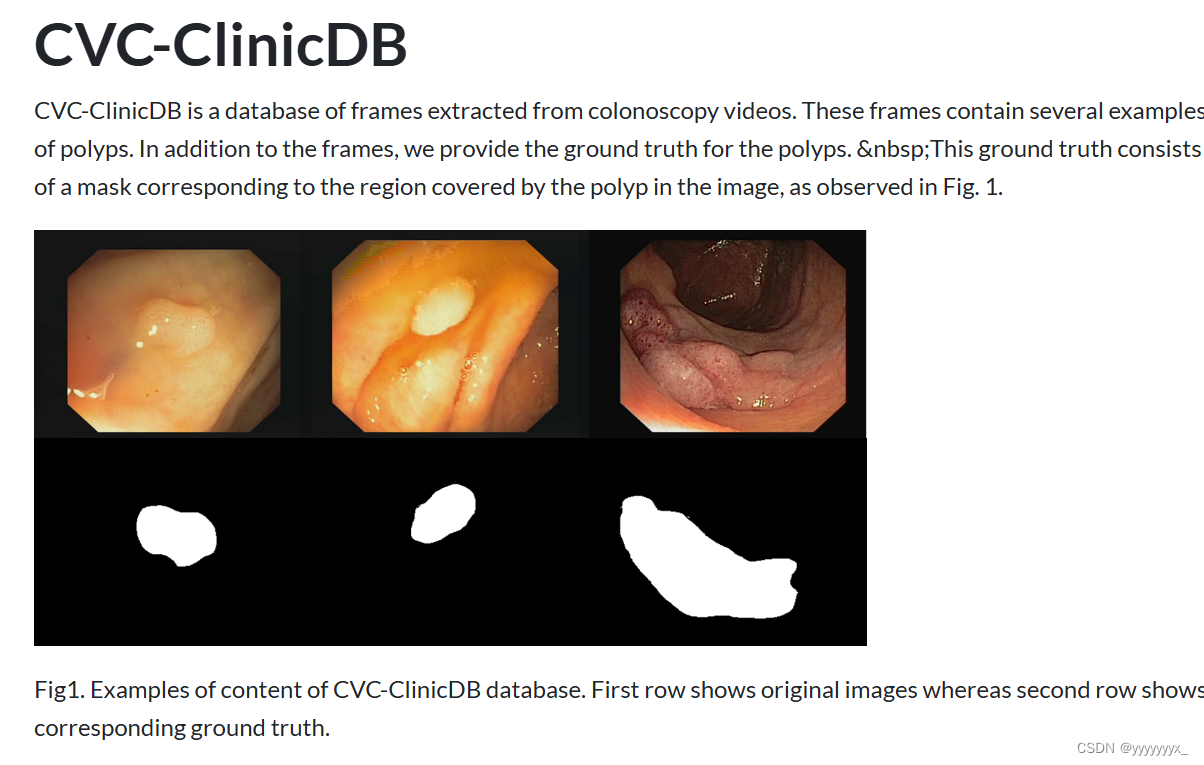 项目实训（九）——数据集的获取_kvasir-seg-CSDN博客