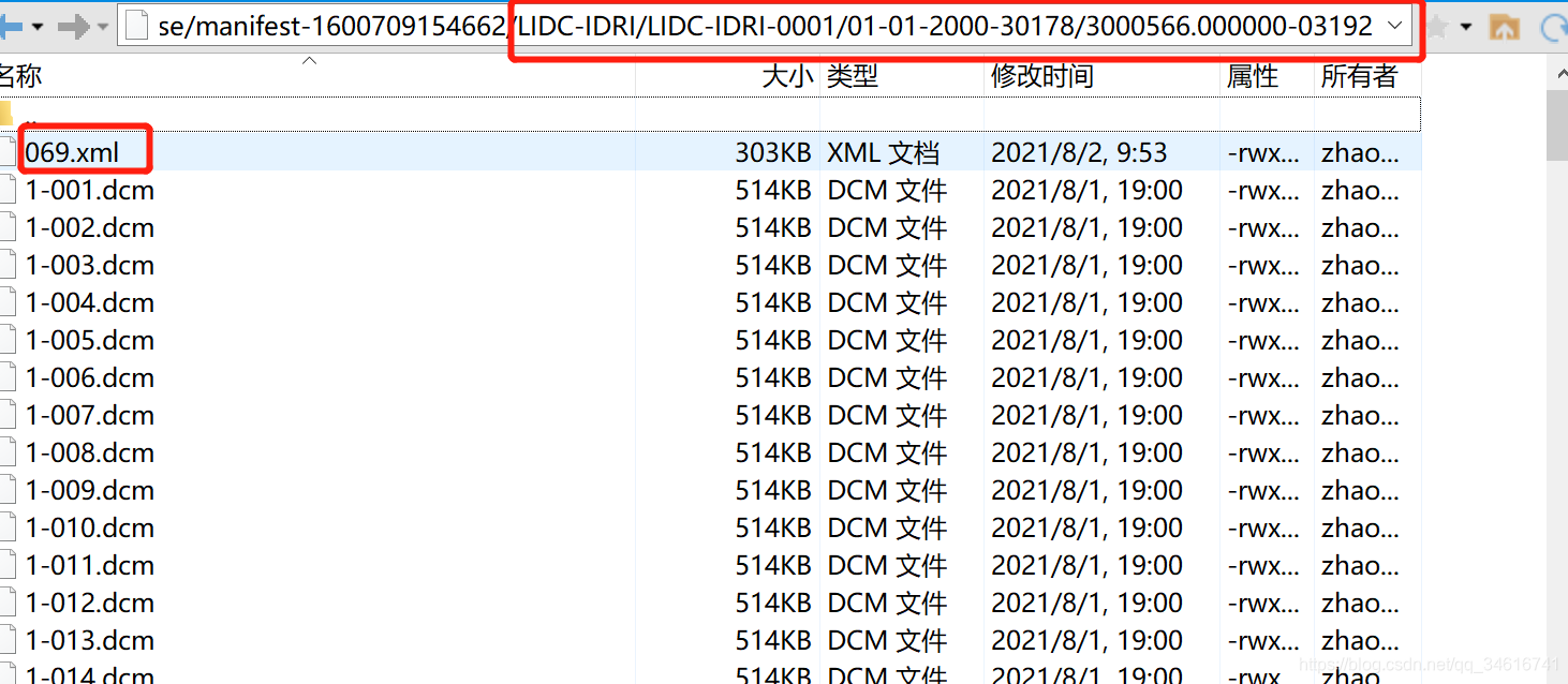 LIDC-IDRI数据集的dicom文件XML标注读取_lidc-idri数据集xml文件注解-CSDN博客
