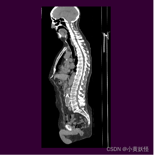 使用CornerStone.js出现的SharedArrayBuffer is NOT supported in your browser-CSDN博客