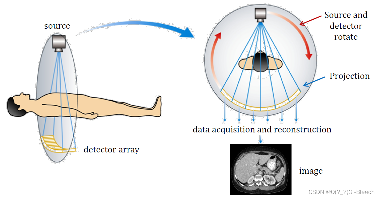 Radon变换与Matlab代码_radon变换 正弦图-CSDN博客