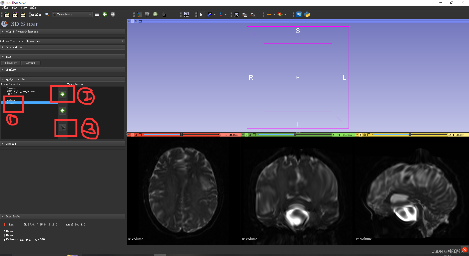 使用3D Slicer进行图像配准_使用3dslicer配准lpba40-CSDN博客