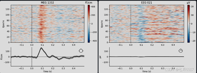 Python-MNE全套教程（官网翻译）-入门01：概述篇_mne-python-CSDN博客