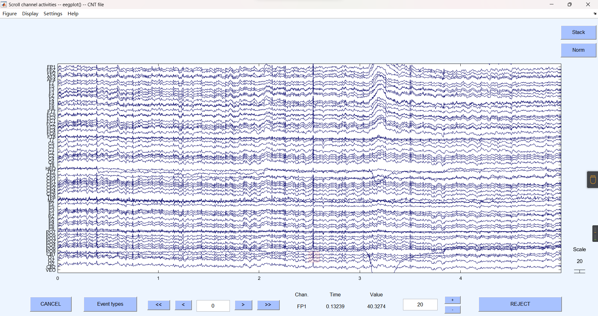 EEGLAB处理运动想象脑电数据-CSDN博客
