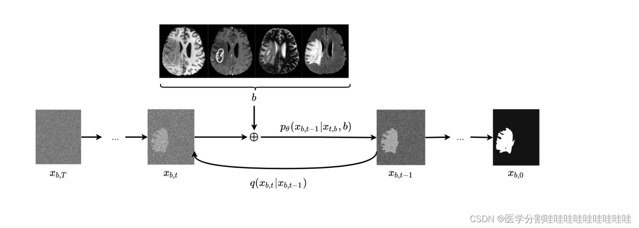 Diffusion Models for Implicit Image Segmentation Ensembles-CSDN博客