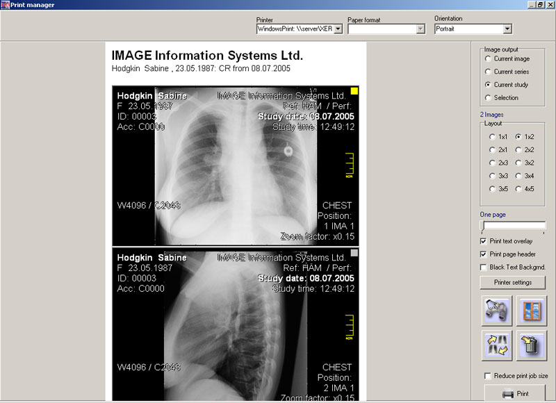 【转】DICOM开发工具总结_dvtk dicom validation tool-CSDN博客