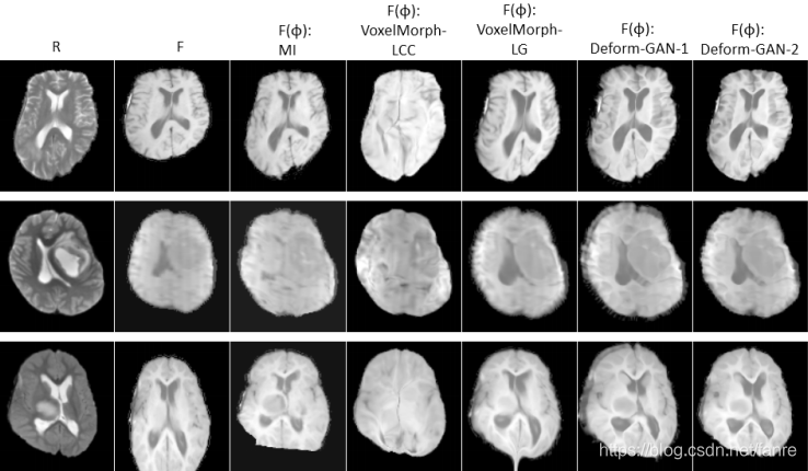 DEFORM-GAN:AN UNSUPERVISED LEARNING MODEL FOR DEFORMABLE REGISTRATION-CSDN博客