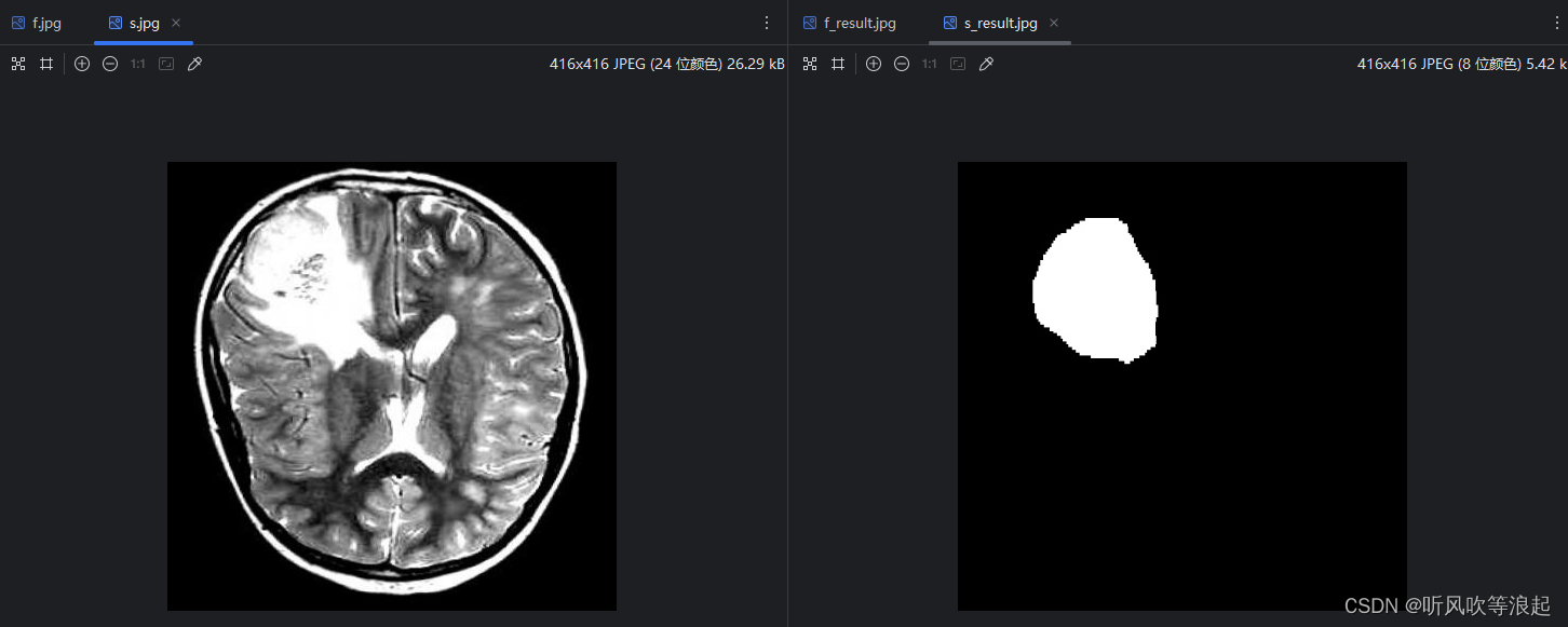 基于UnetPlusPlus(Unet++)实现的医学图像分割-CSDN博客