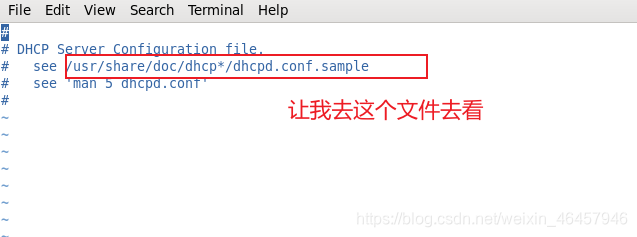 dhcp服务配置 [Linux] 超详细的步骤！学不会你打我！_dhcpd interface-CSDN博客