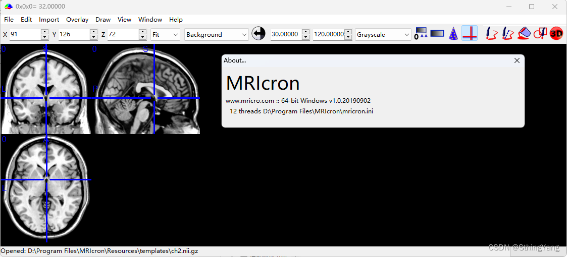 fMRI数据处理：从DICOM到NIFTI（上）_mricorn-CSDN博客