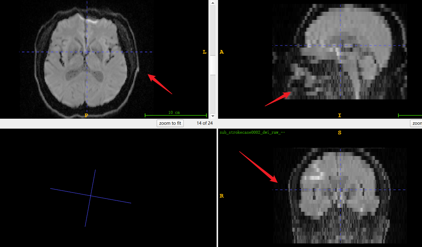 医学影像中用python 将NRRD批量转换成NIFTI_nrrd nifit 医学图像转换-CSDN博客