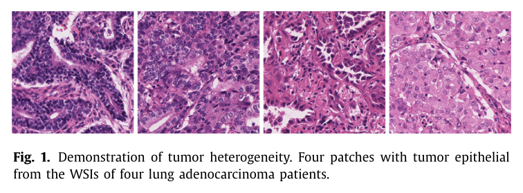 【论文阅读】Multi-layer pseudo-supervision for histopathology tissue semantic segmentation using patch ...
