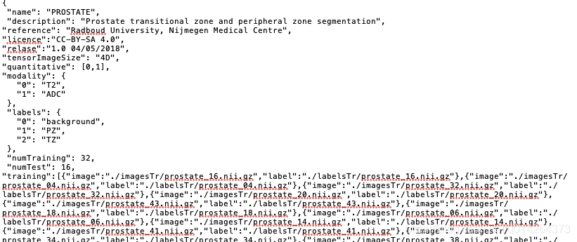 nnUNet实战一使用预训练nnUNet模型进行推理_预训练的u-net模型-CSDN博客