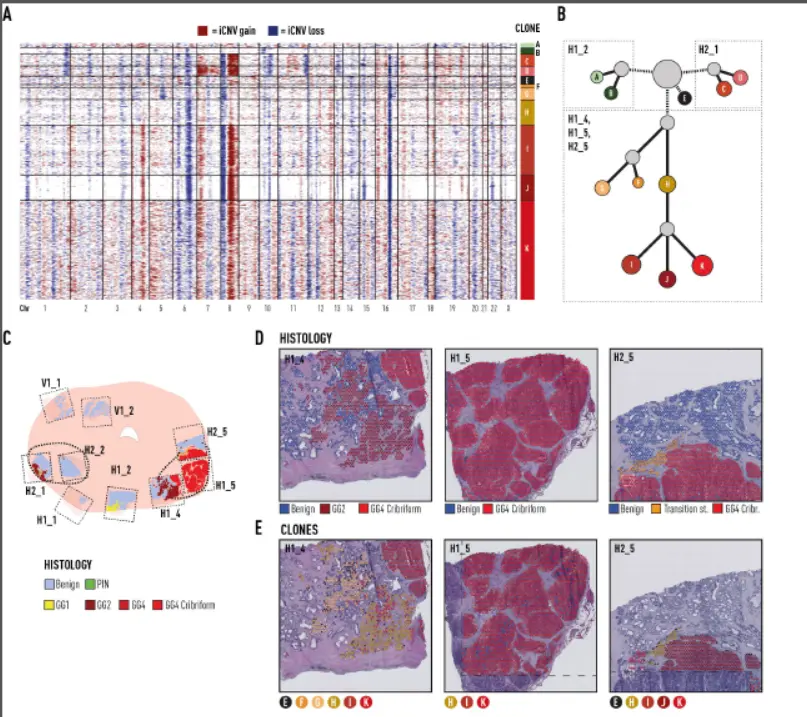 10X空间转录组数据分析之CNV事件的spatial landscape_cnvs height distribution-CSDN博客
