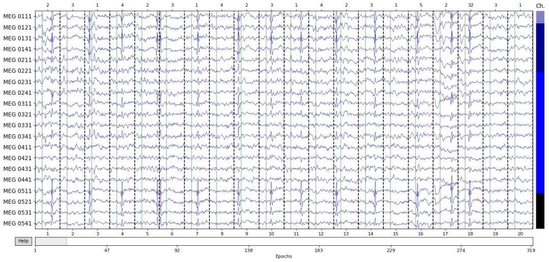脑电分析系列[MNE-Python-15]| Epochs数据可视化-CSDN博客