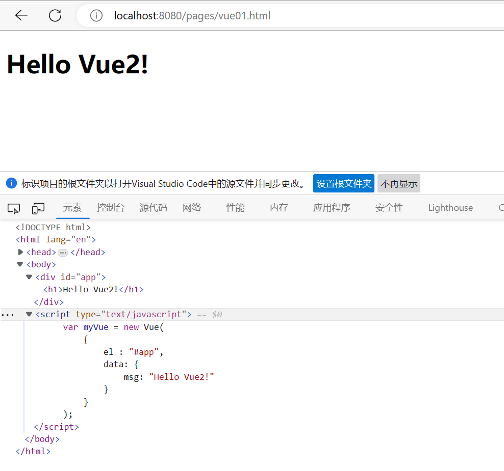 Vue2_01_data_插值_vue的插值语法获取data-CSDN博客
