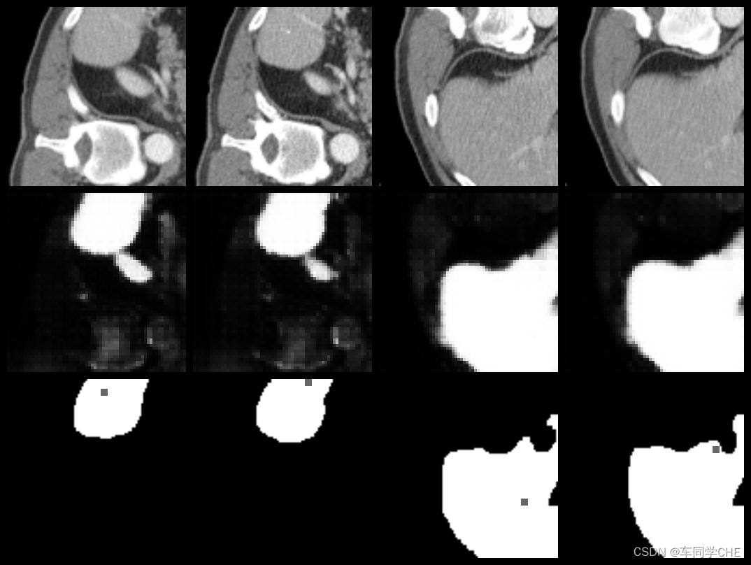 论文代码复现之Medical SAM Adapter (Junde Wu version)_raise runtimeerror(f ...