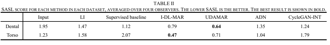 Metal Artefact Reduction with Unsupervised Domain Adaptation Regularization for Practical CT ...