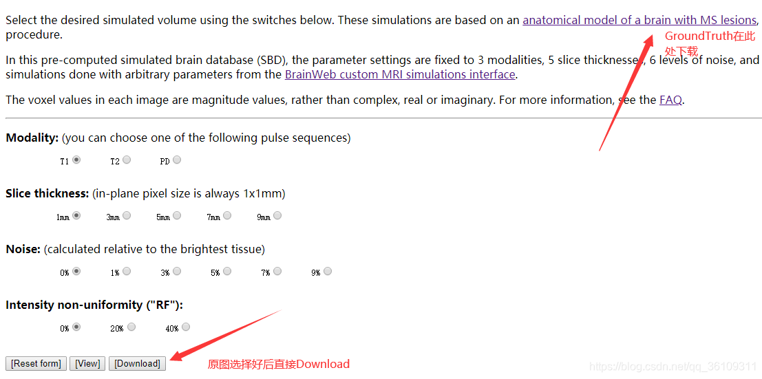 BrainWeb: Simulated Brain Database使用（原图以及GroundTruth切片可视化）和矢状冠状横断面-CSDN博客