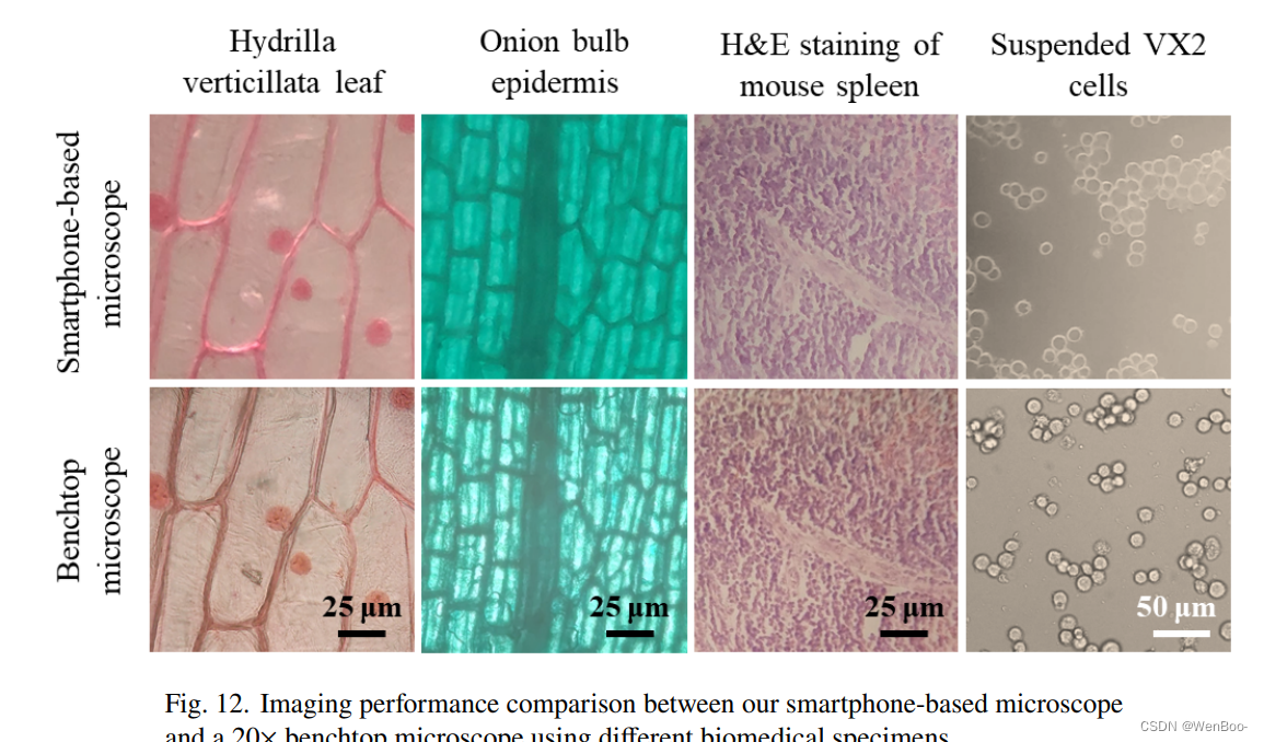 HierarchicalVisionTransformersforProstateCancer&FederatedMedicalImagingAdvancements-CSDN博客