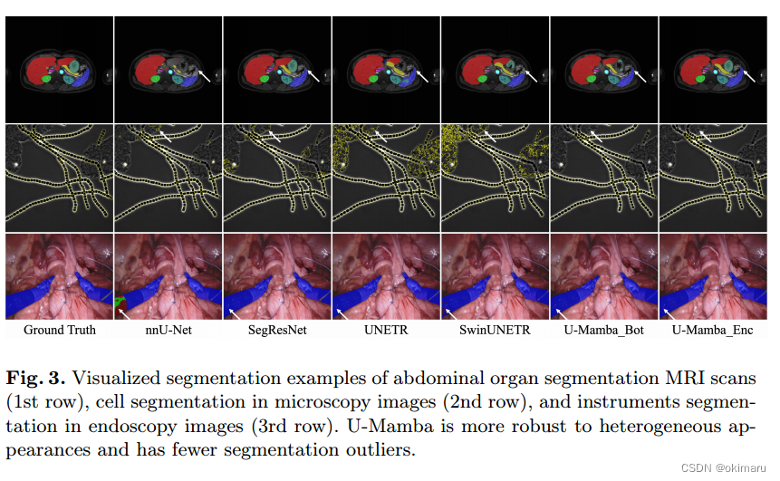 U Mamba Enhancing Long Range Dependency For Biomedical Image Segmentation Csdn博客