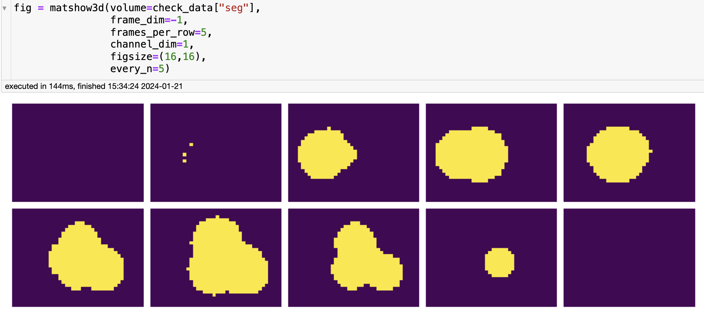 从三维图像中抽取2D样本进行训练-MONAI实战_monai 1.3.0-CSDN博客