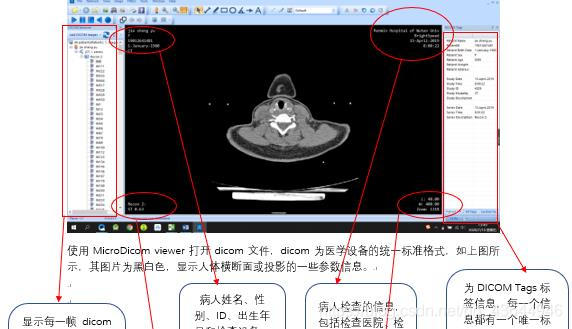 医学影像与MicroDicom-CSDN博客