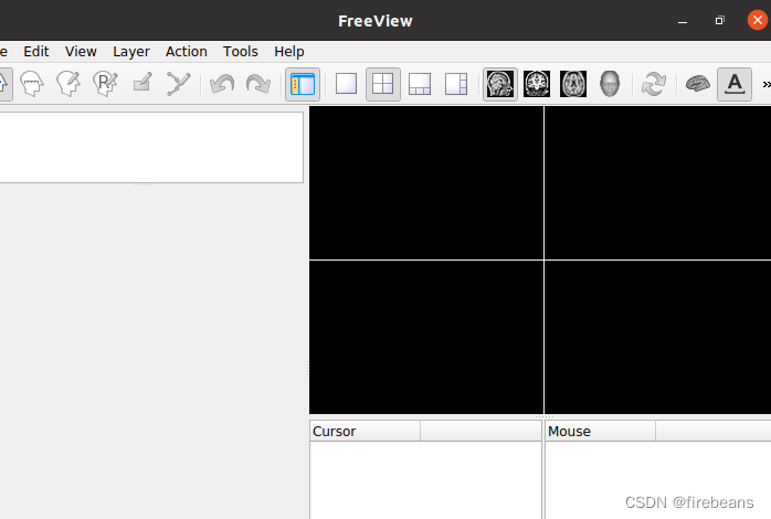 FreeSurfer入门(1) Output Data-CSDN博客