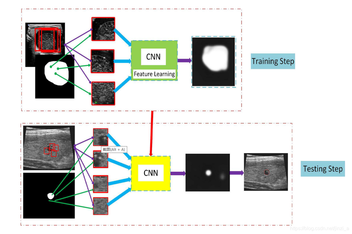 2017Ultrasound image-based thyroid nodule automatic segmentation using ...