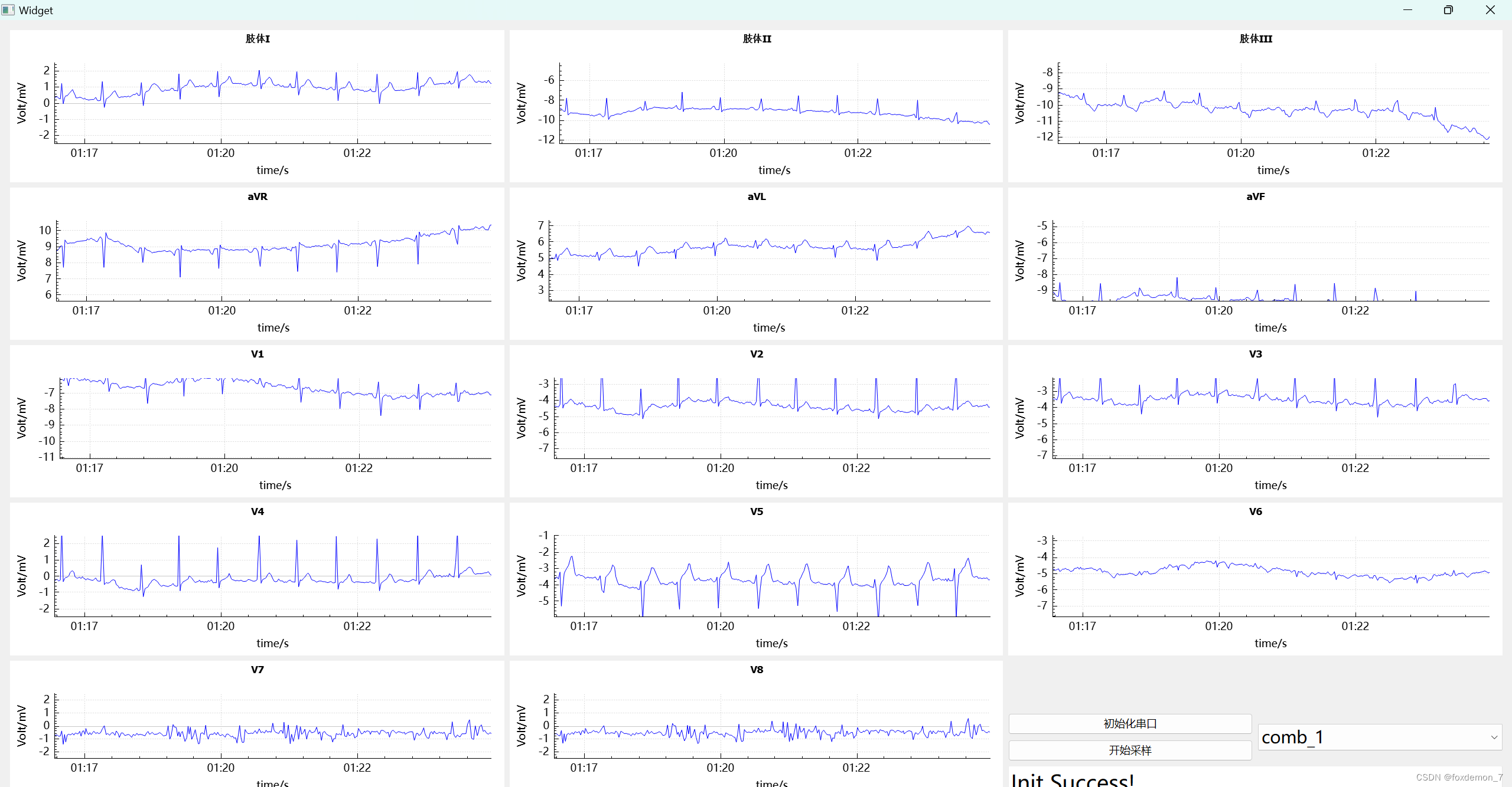 FPGA控制ADS1298_ads1298r spi dout drdy-CSDN博客