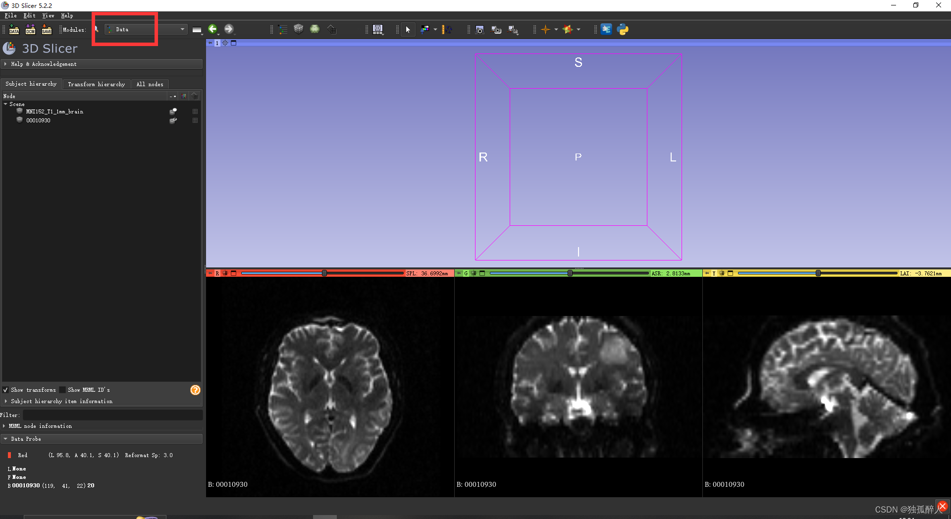 使用3D Slicer进行图像配准_使用3dslicer配准lpba40-CSDN博客