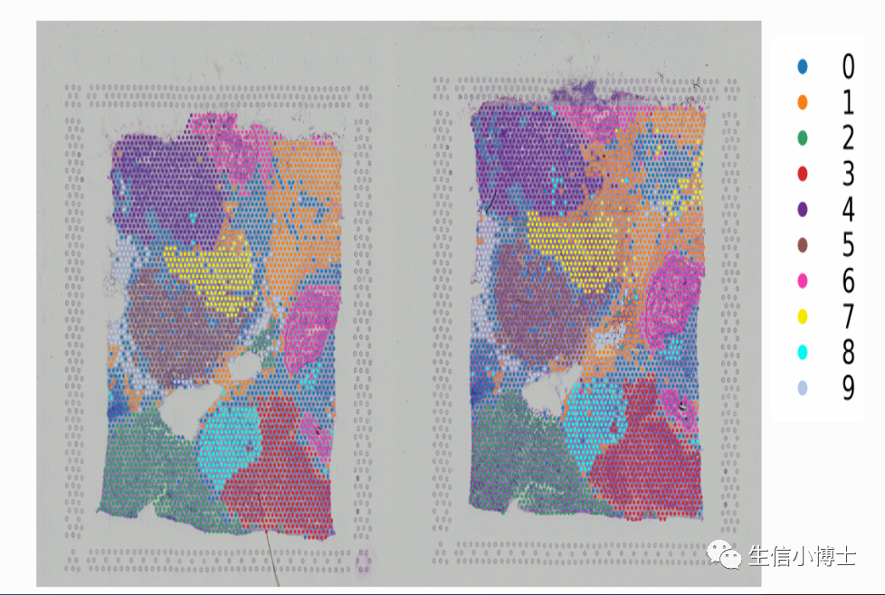 空间转录组 多样本整合分析—stlearn-CSDN博客