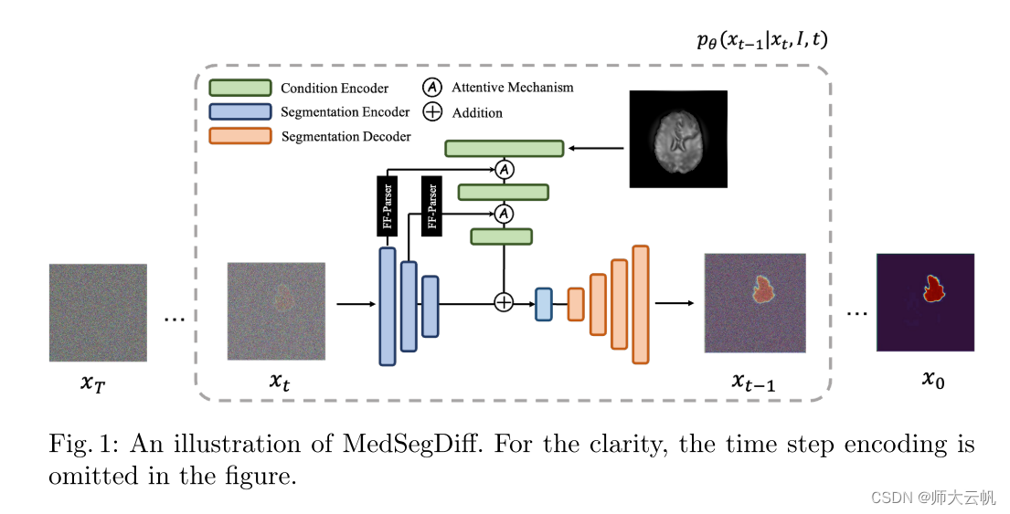 diffusion medical image segmentation_diffusion models for implicit image segmentation e-CSDN博客